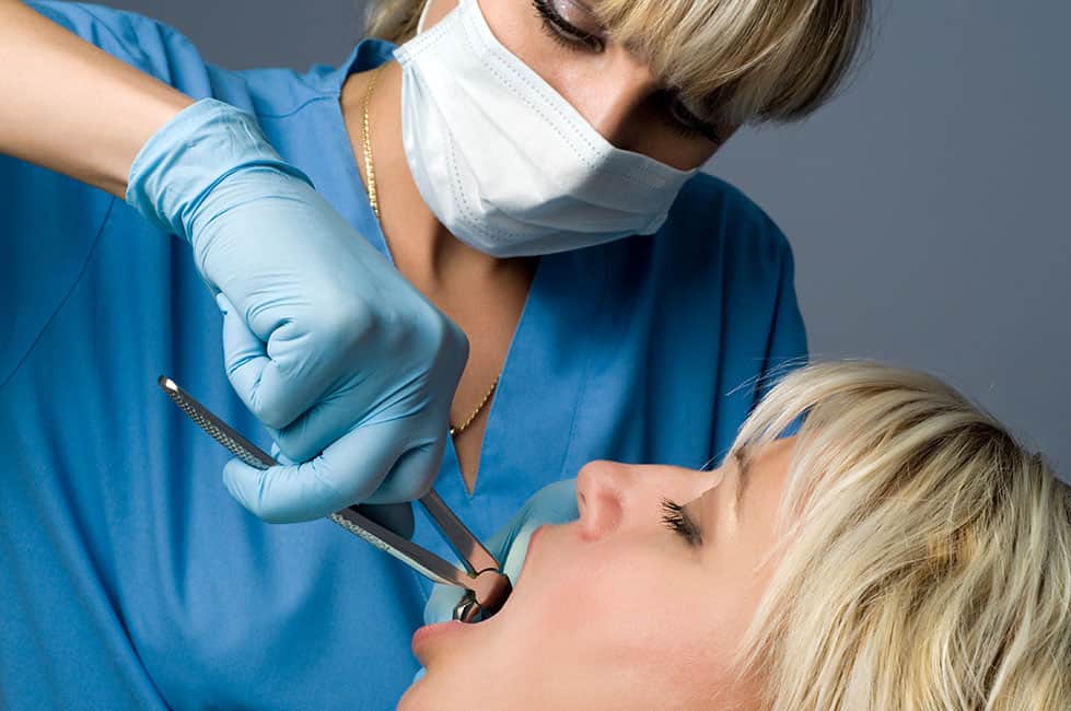 Teeth Extractions In Mill Woods Edmonton Agape Dental Clinic